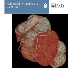 Multimodality Imaging of a Silent Killer - Case-based CME | Houston Methodist